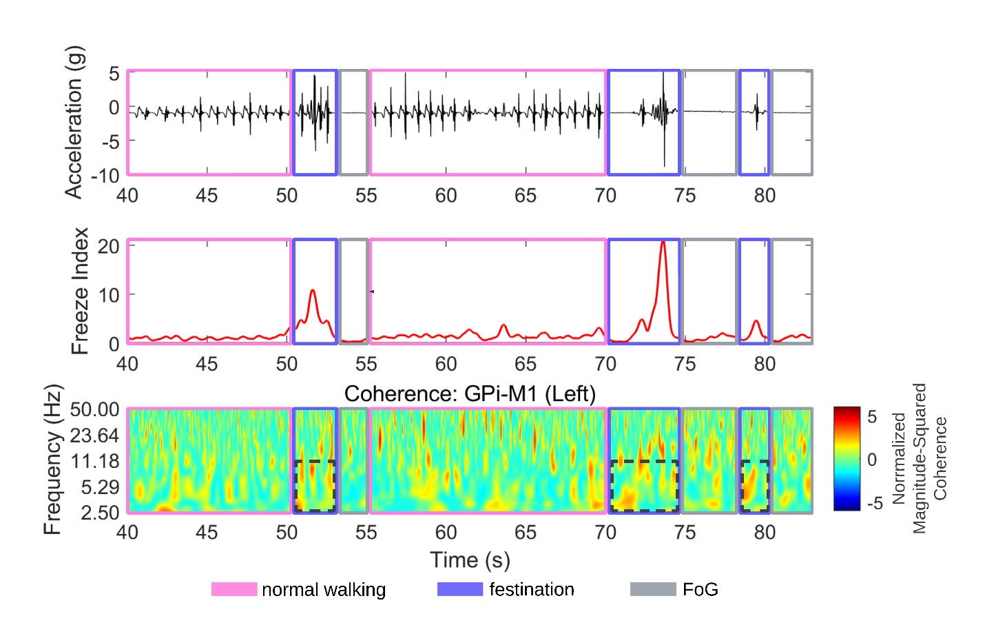 Neural Control of Gait Functions in Parkinson’s Disease | Wang Lab | Unraveling circuit dynamics ...
